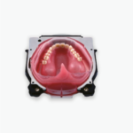 DIGITAL DENTURE SOLUTION - DGSHAPE
